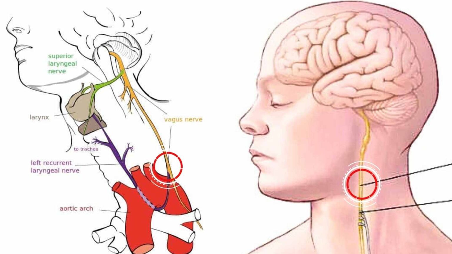 Wonderful Vagus Nerve Stimulation 10 Tips For Mental Health