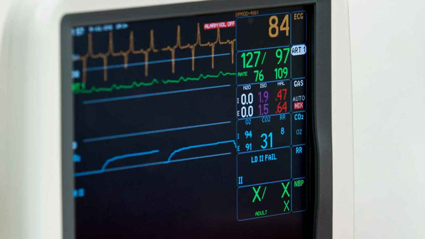 Optimize Workouts with Sole Heart Rate Monitor (2026)